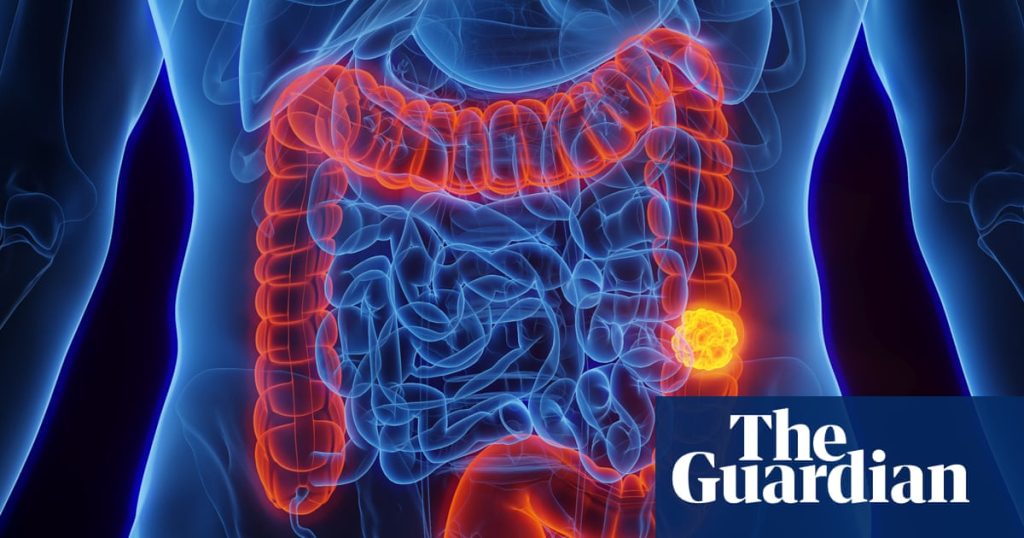 Understanding Colorectal Cancer: Prevention and Awareness - Oz Arab Media